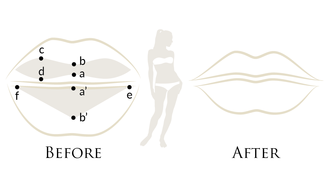 Lip Reduction Surgery in New York City NYC | Lip Reduction Manhattan