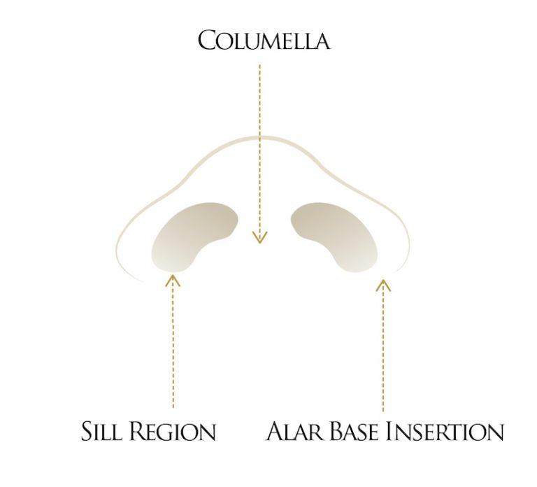 Nasal Base Reduction New York City NYC | Alar Base Narrowing Manhattan