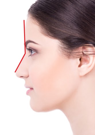 Nasal Analysis in Rhinoplasty New York City NYC Manhattan
